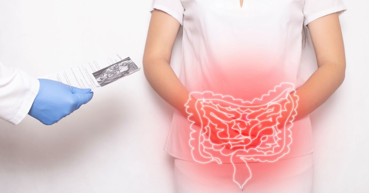 Colite Intestinal: Explorando Sintomas e Opções de Tratamento - Blog Hera